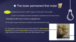 Variations in lower permanent molars | PPTX