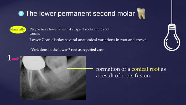 Variations in lower permanent molars | PPT