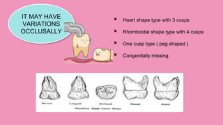 Variations in maxillary molars | PPTX