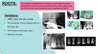 Variations in maxillary molars | PPTX