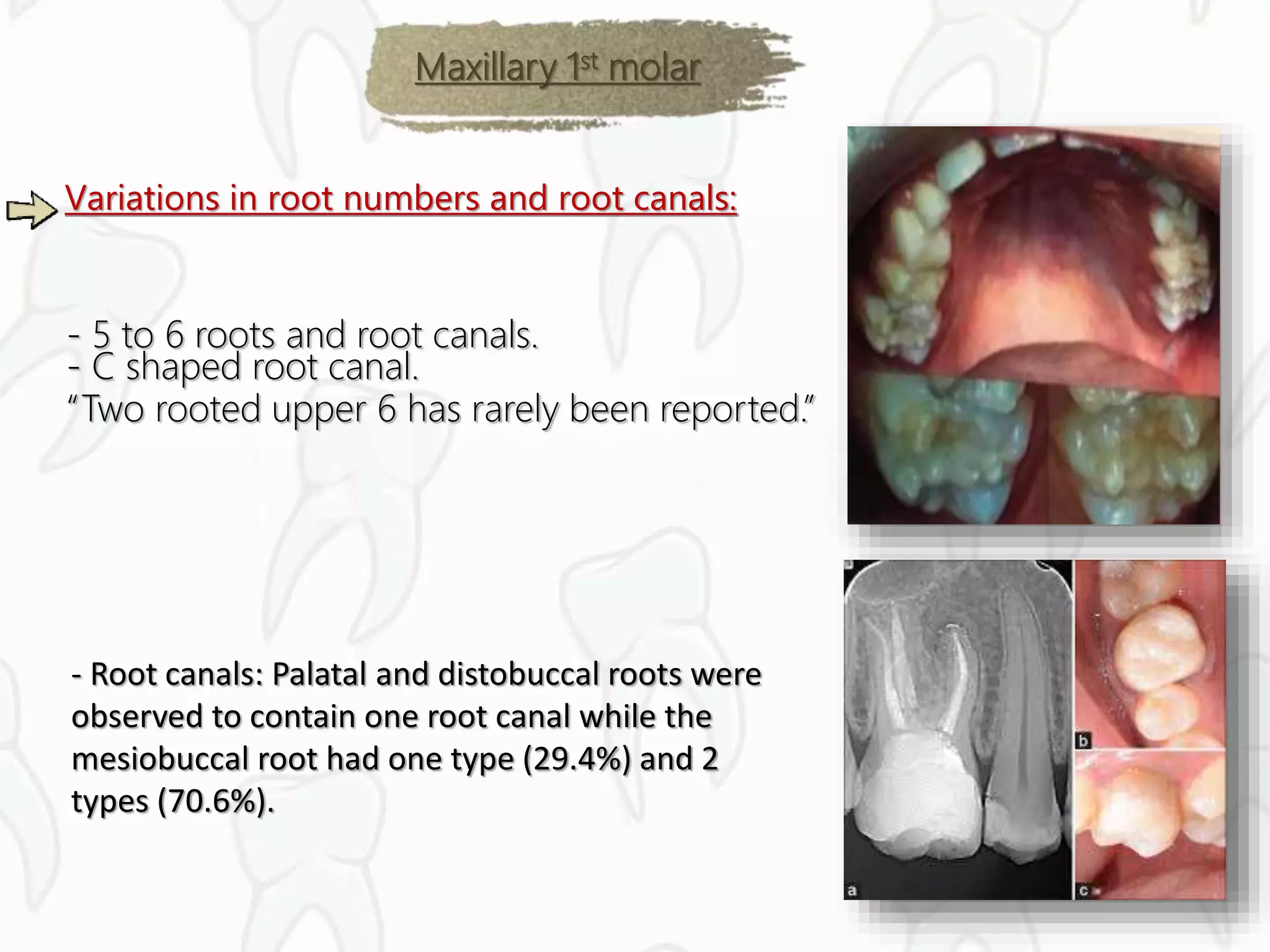 Variations in maxillary molars | PPTX | Dental Health | Diseases and ...