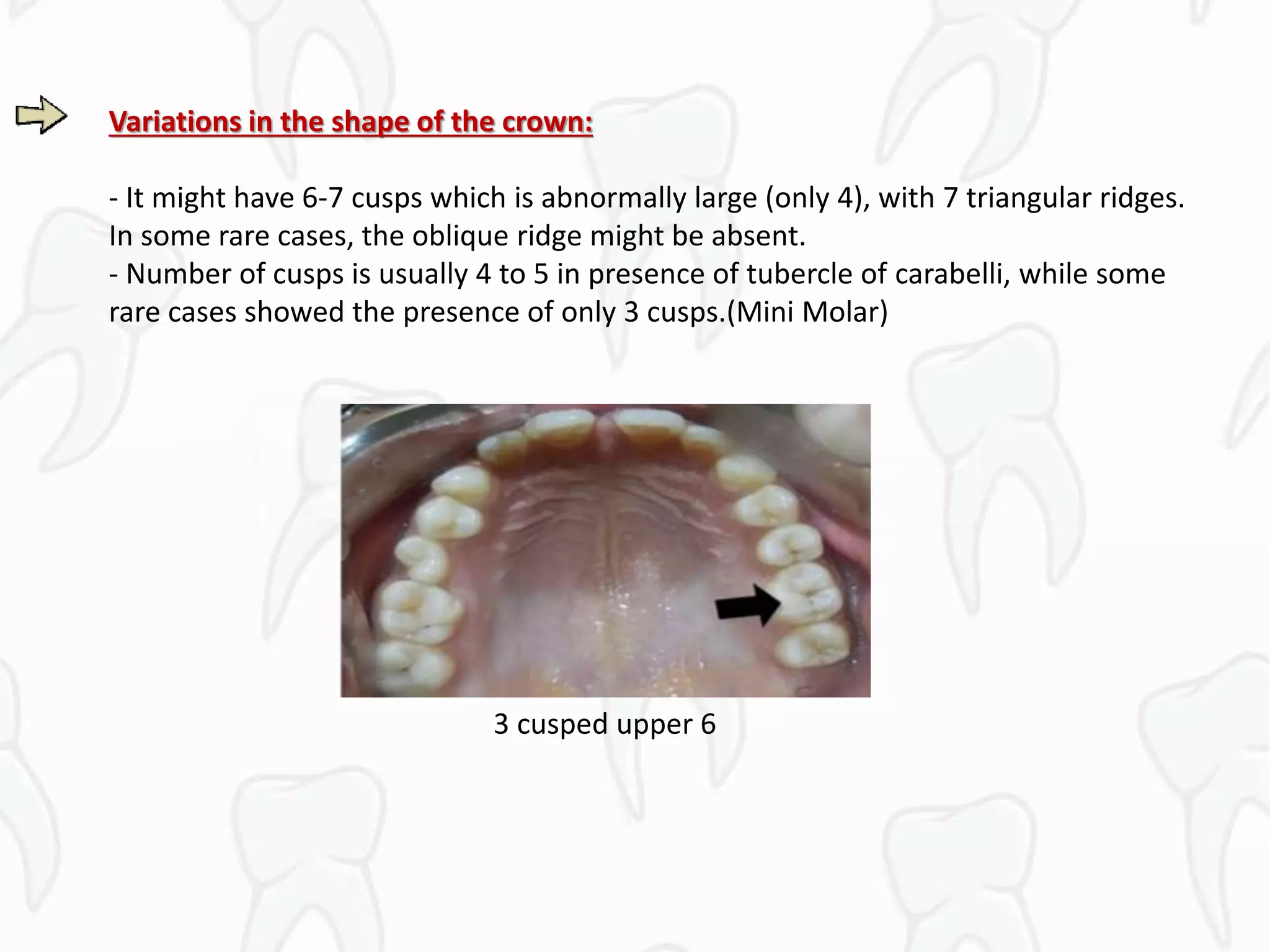 Variations in maxillary molars | PPTX | Dental Health | Diseases and ...
