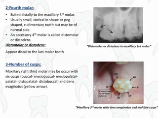 Variations in maxillary molars | PPTX | Dental Health | Diseases and ...