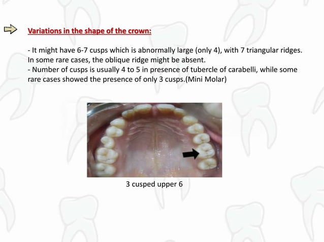 Variations in maxillary molars | PPTX | Dental Health | Diseases and ...