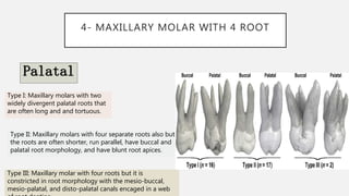 Variations of maxillary molars | PPT