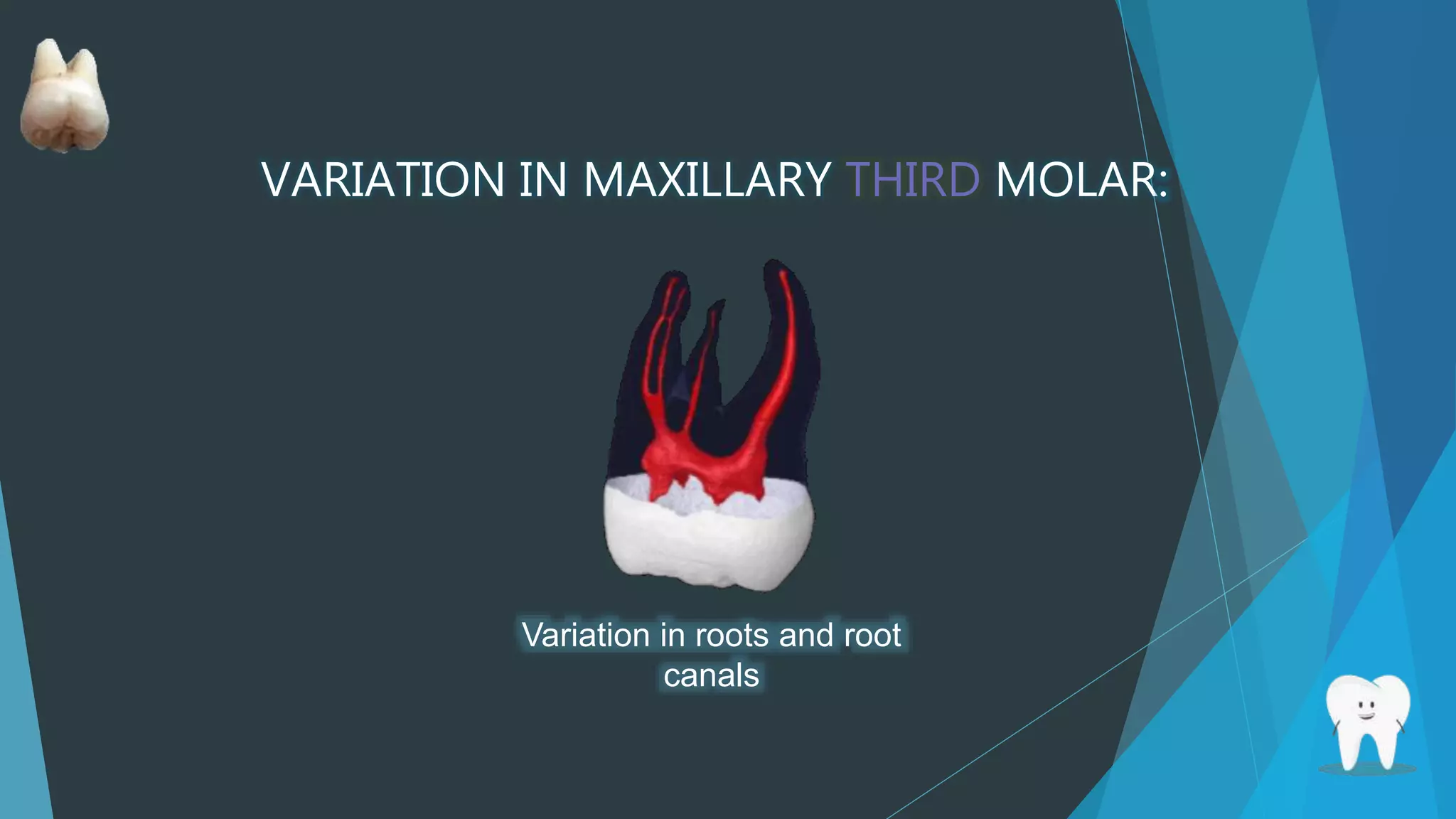 Variations of maxillary molars | PPTX