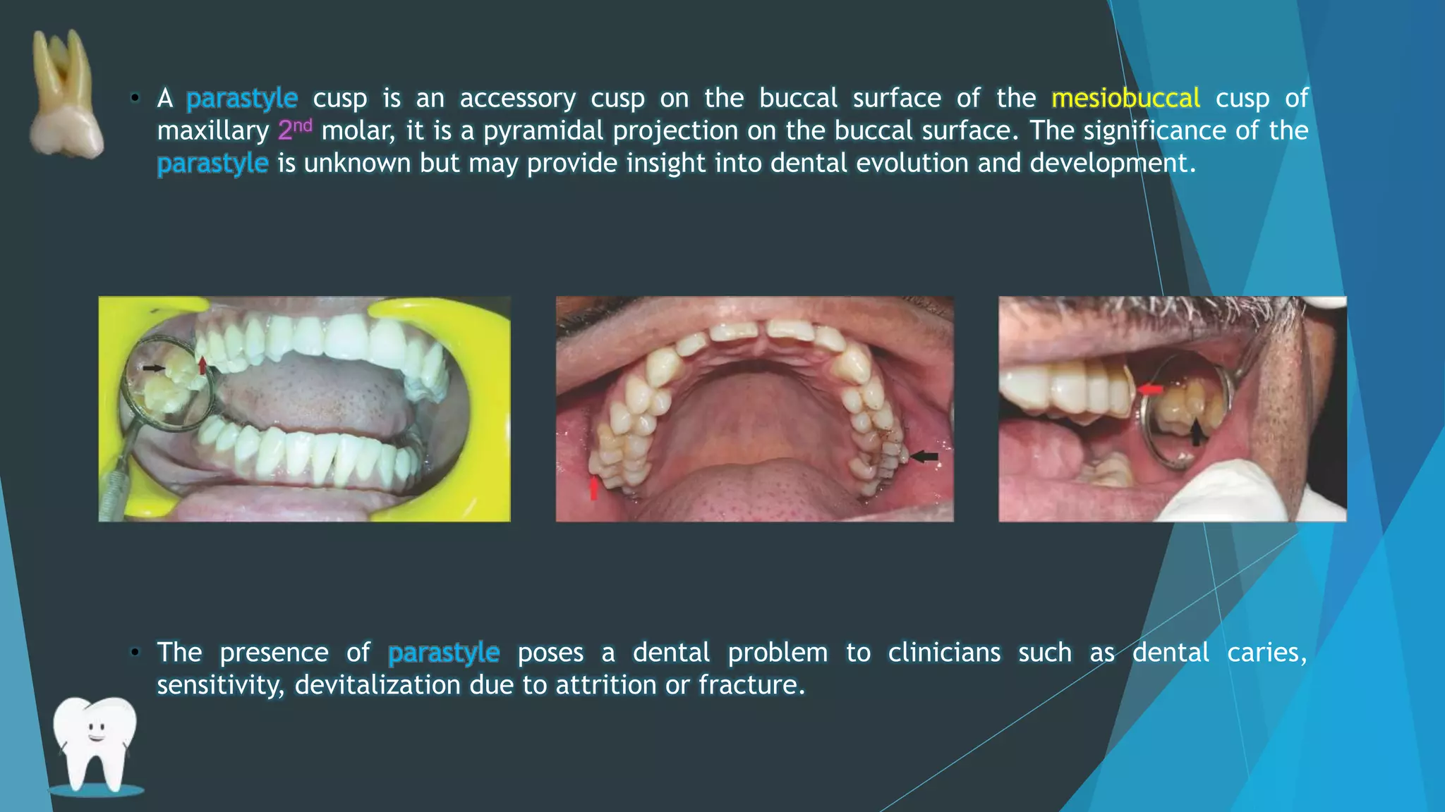 Variations of maxillary molars | PPTX