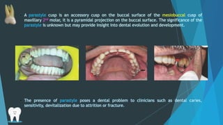 Variations of maxillary molars | PPT