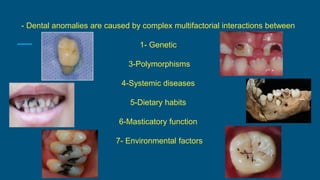 Variations of maxillary permenant molars | PPTX