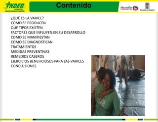Varice copia | PDF