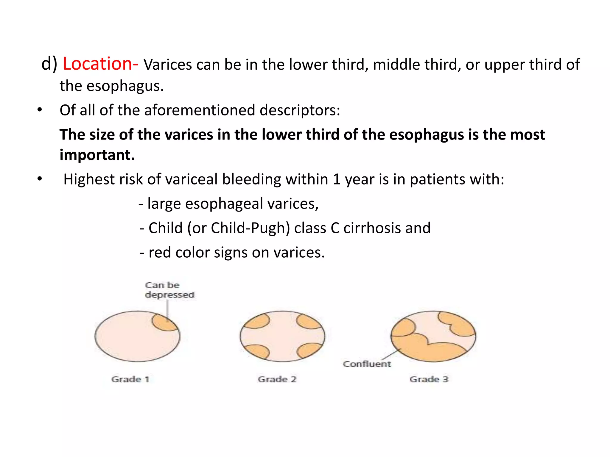 variceal bleeding.pdf