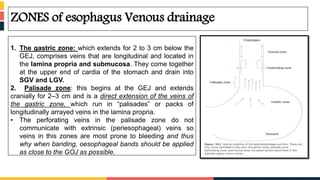 variceal bleeding 2.pdf