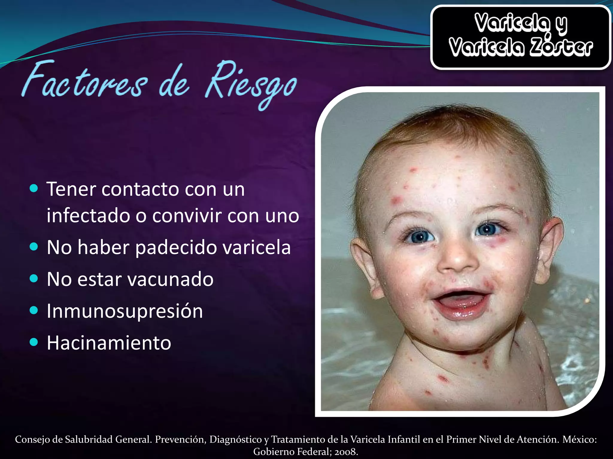Varicela & varicela zóster | PPT