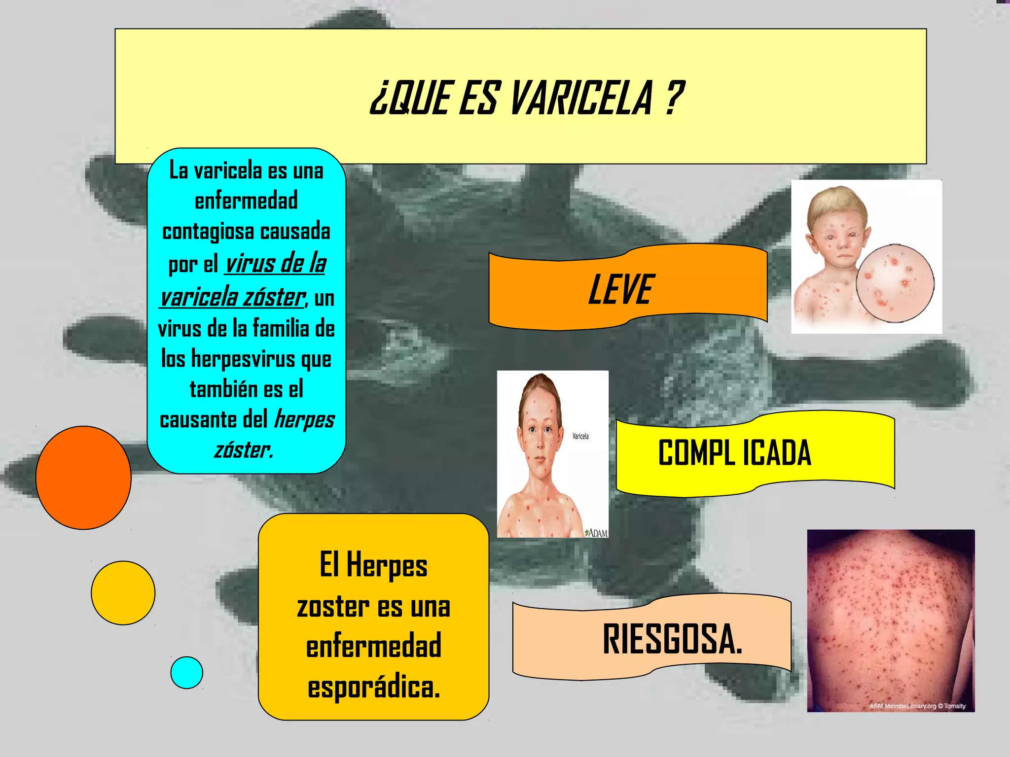 Varicela zoster | PPT