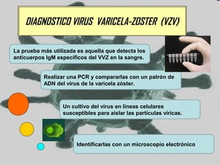 Varicela zoster | PPT