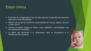 Varicela y exantema súbito | PPTX