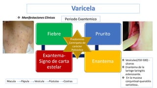 Varicela y herpes | PPTX
