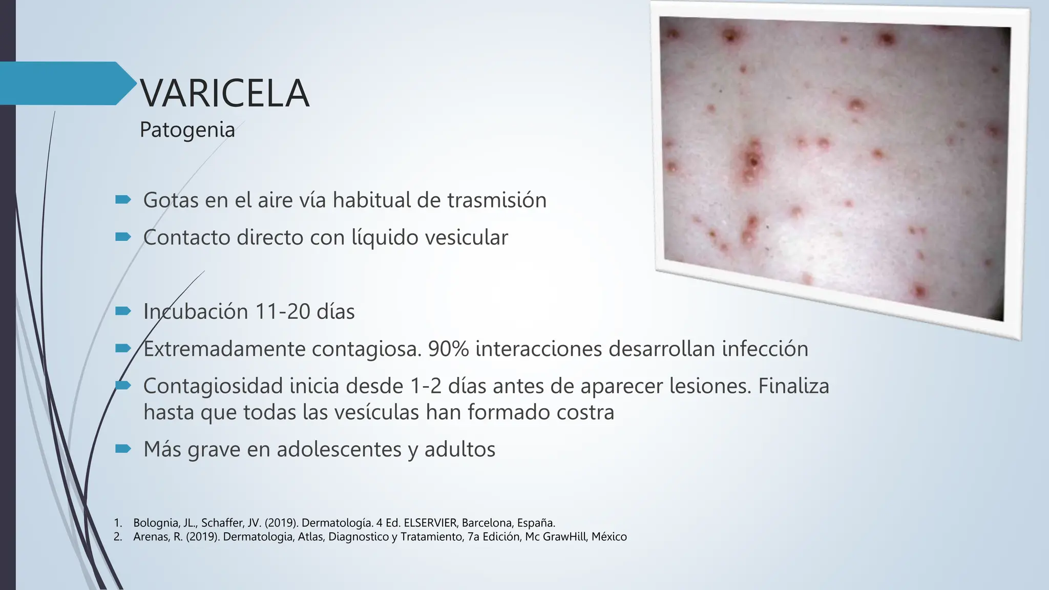Varicela y Herpes Zoster. Dermatología Primer Año | PPT