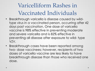 VARICELLA- INFECTIOUS VIRAL DISEASE .pptx