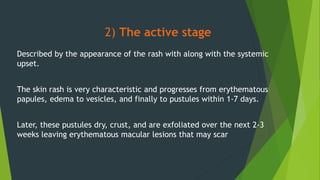 Varicella zoster virus | PPTX