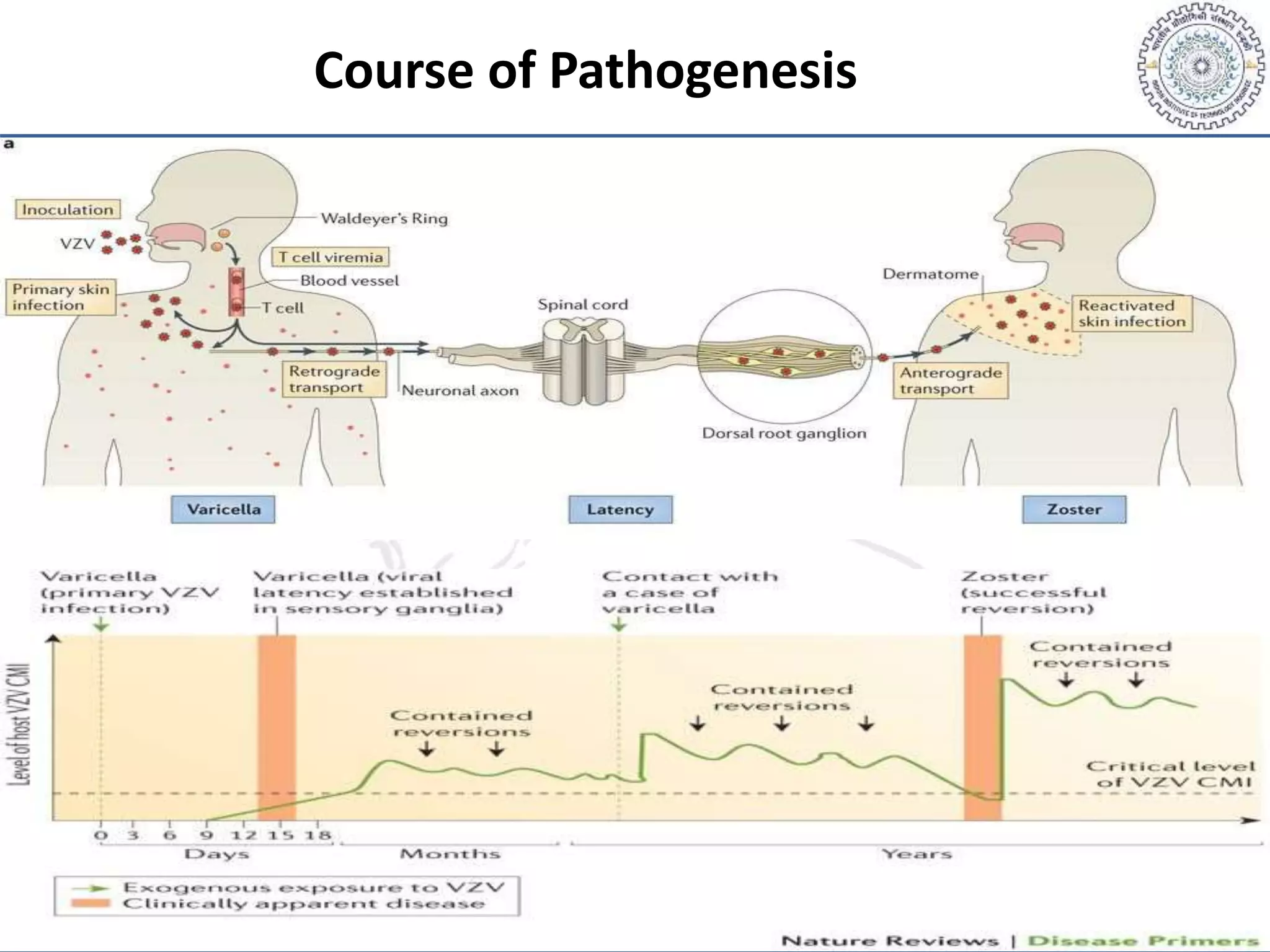 Varicella structure, genome and pathogenesis | PPTX
