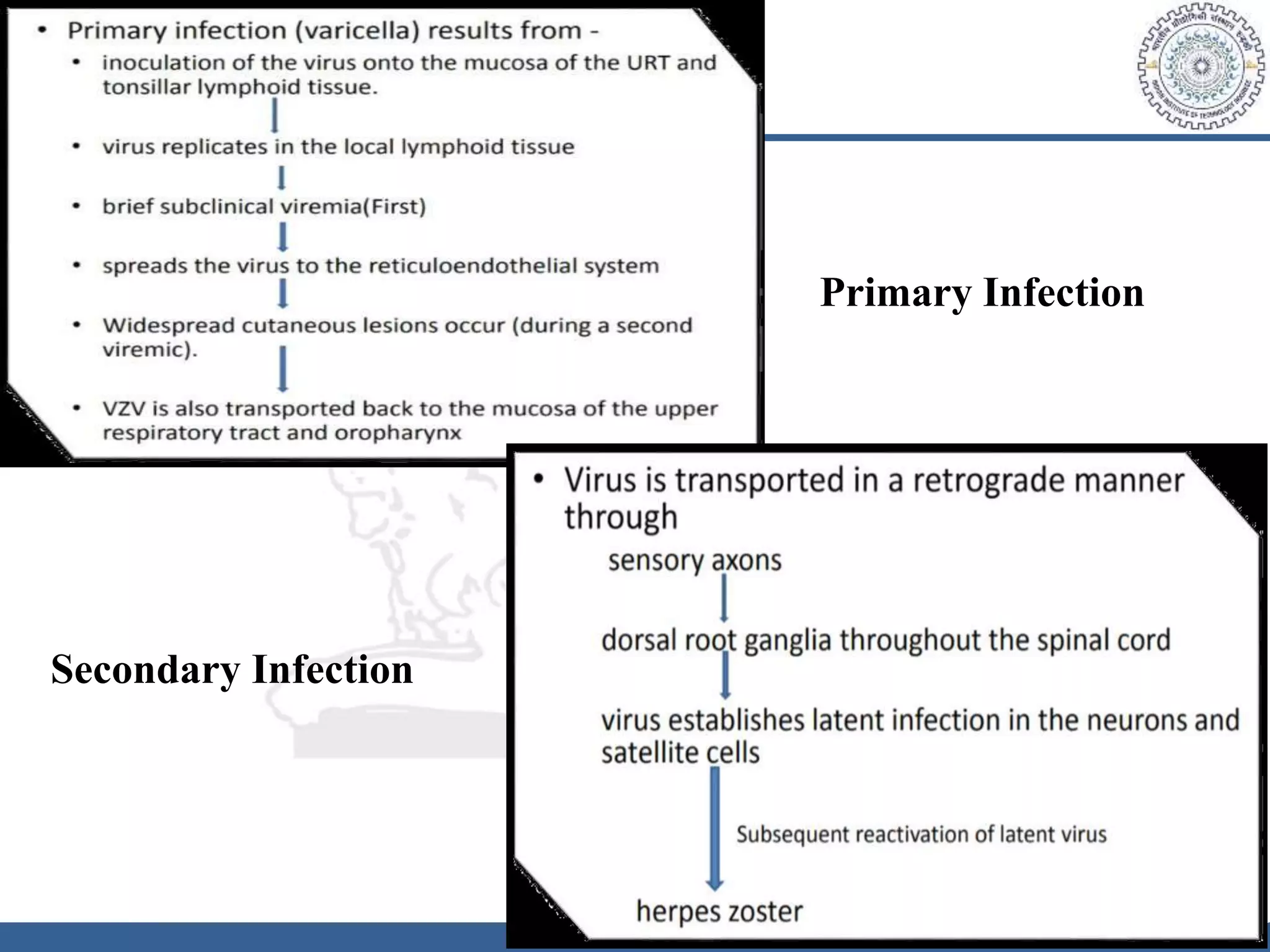 Varicella structure, genome and pathogenesis | PPTX