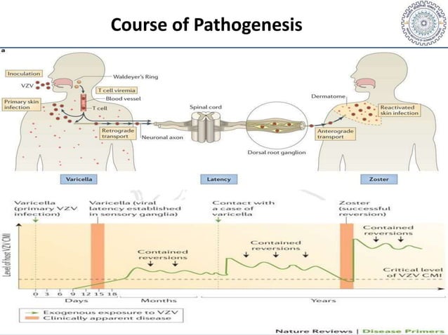 Varicella structure, genome and pathogenesis | PPTX | Infectious ...
