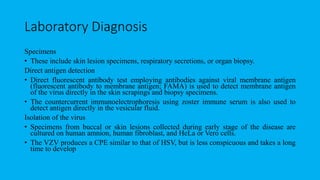Varicella zoster virus | PPTX