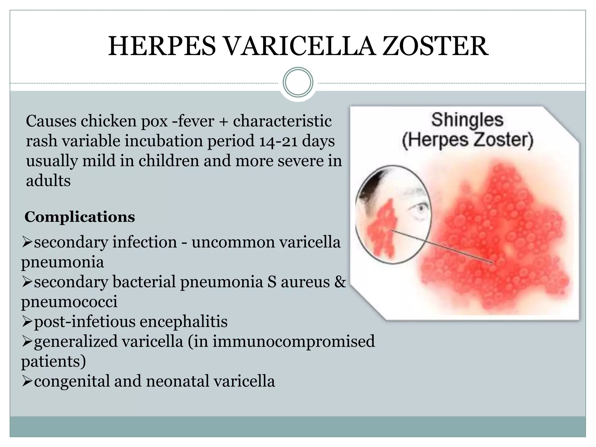 Varicella Zoster Virus Infections | PPTX
