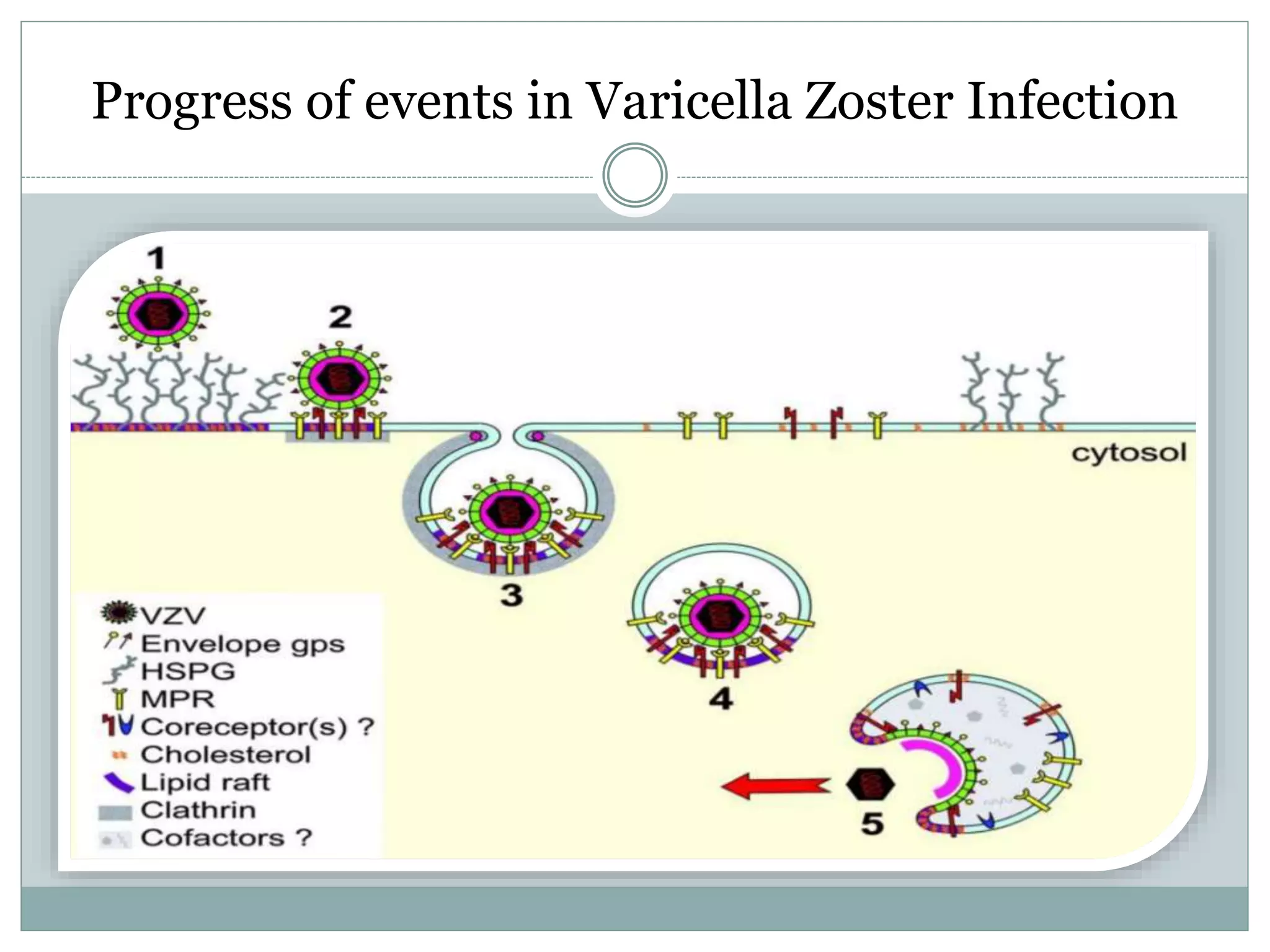 Varicella Zoster Virus Infections | PPTX