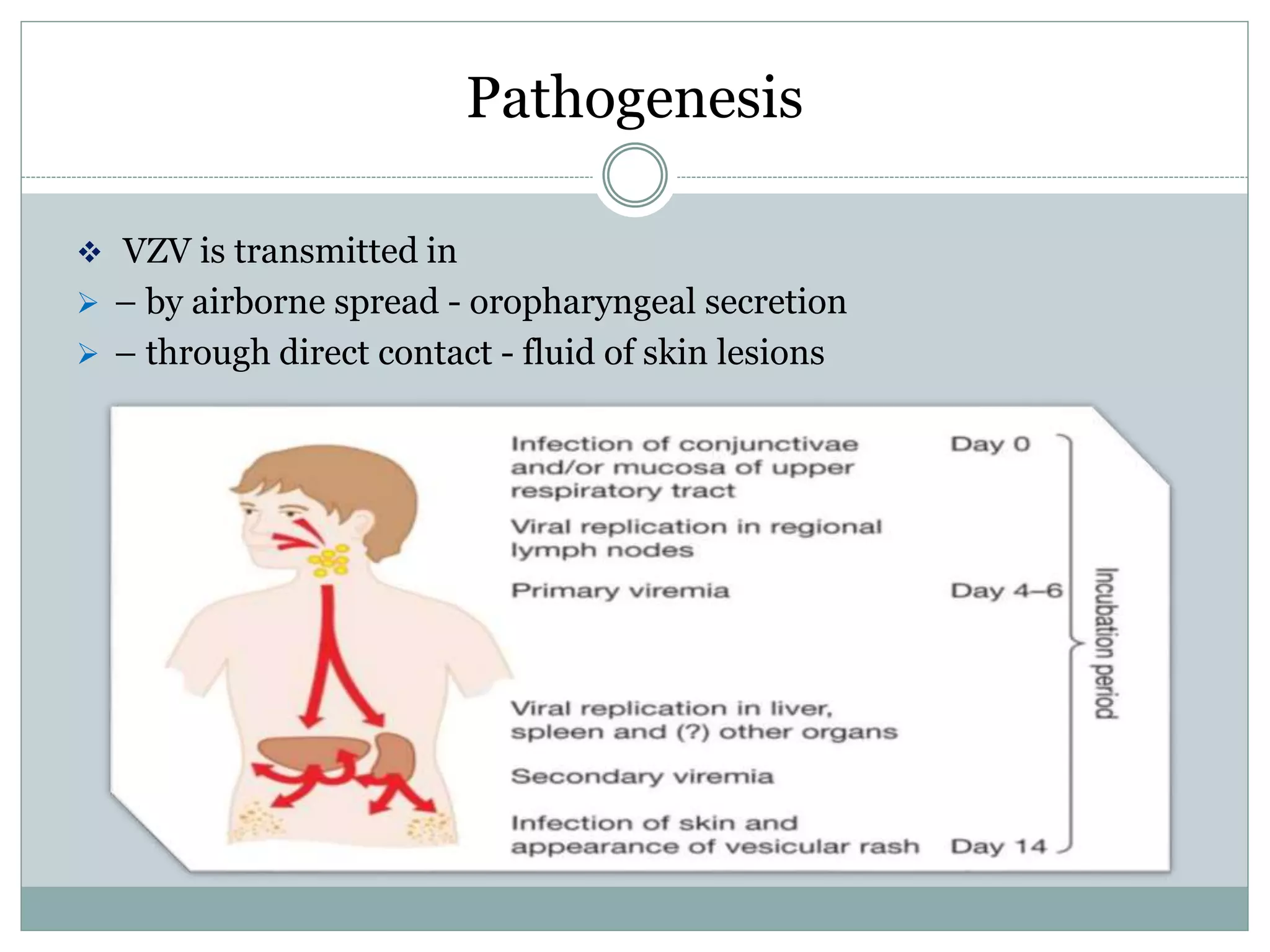 Varicella Zoster Virus Infections | PPTX