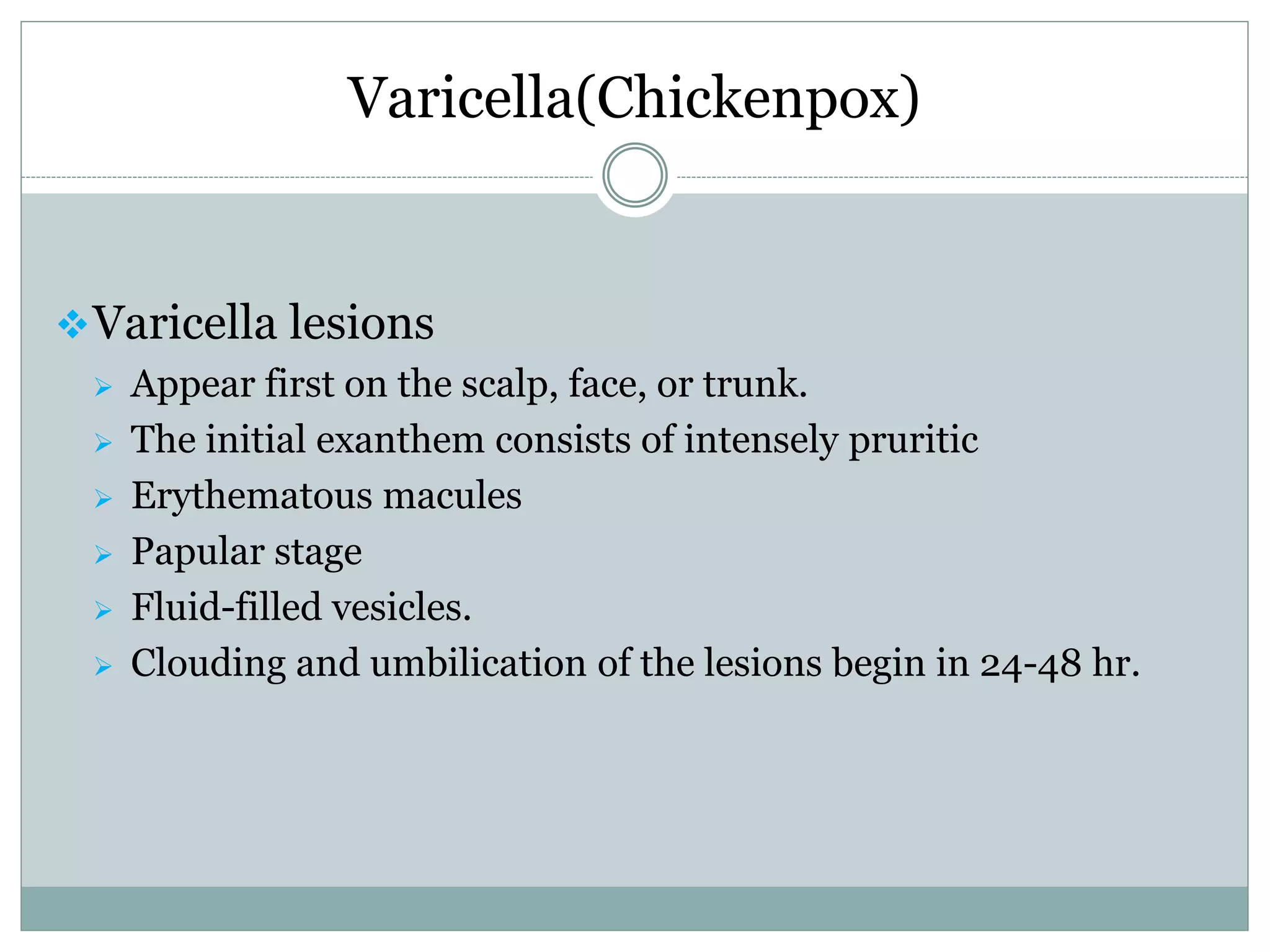 Varicella Zoster Virus Infections | PPTX