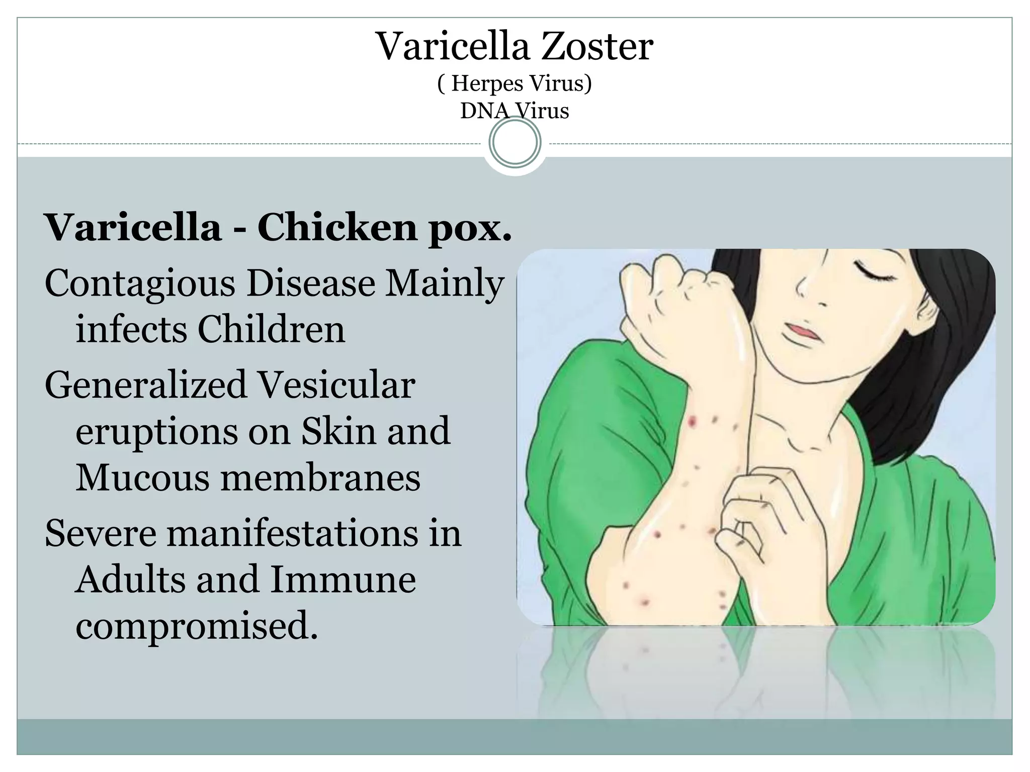 Varicella Zoster Virus Infections | PPTX