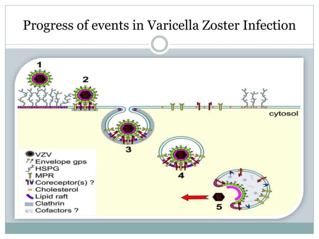 Varicella Zoster Virus Infections | PPTX