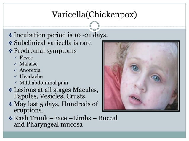 Varicella Zoster Virus Infections | PPTX