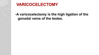 Varicocelectomy | PPTX