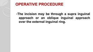 Varicocelectomy | PPTX