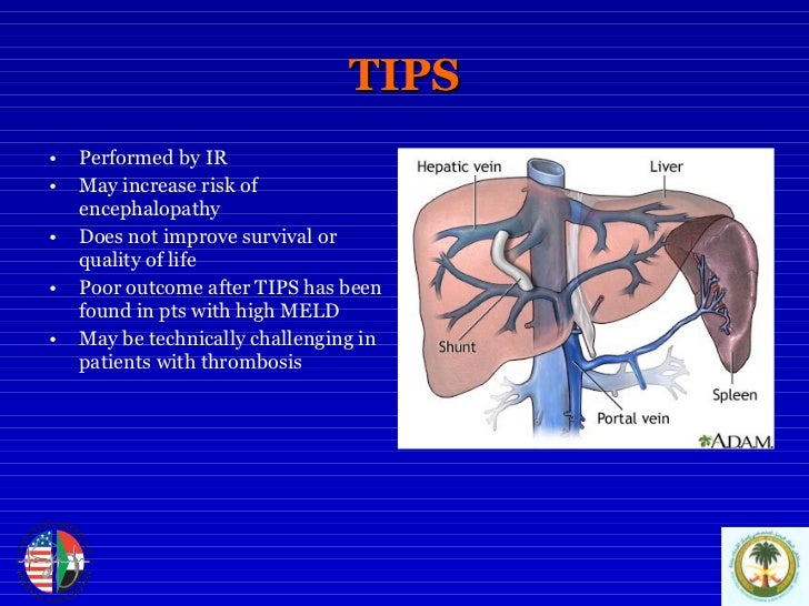 Variceal Bleeding