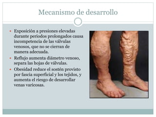 Varices varicosas | PDF