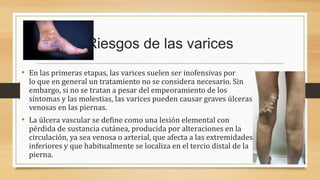 Varices.pptx