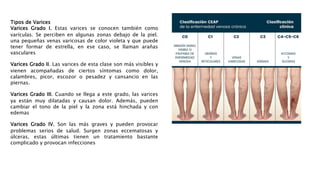Varices que son por qué aparecen y su tratamiento.pptx