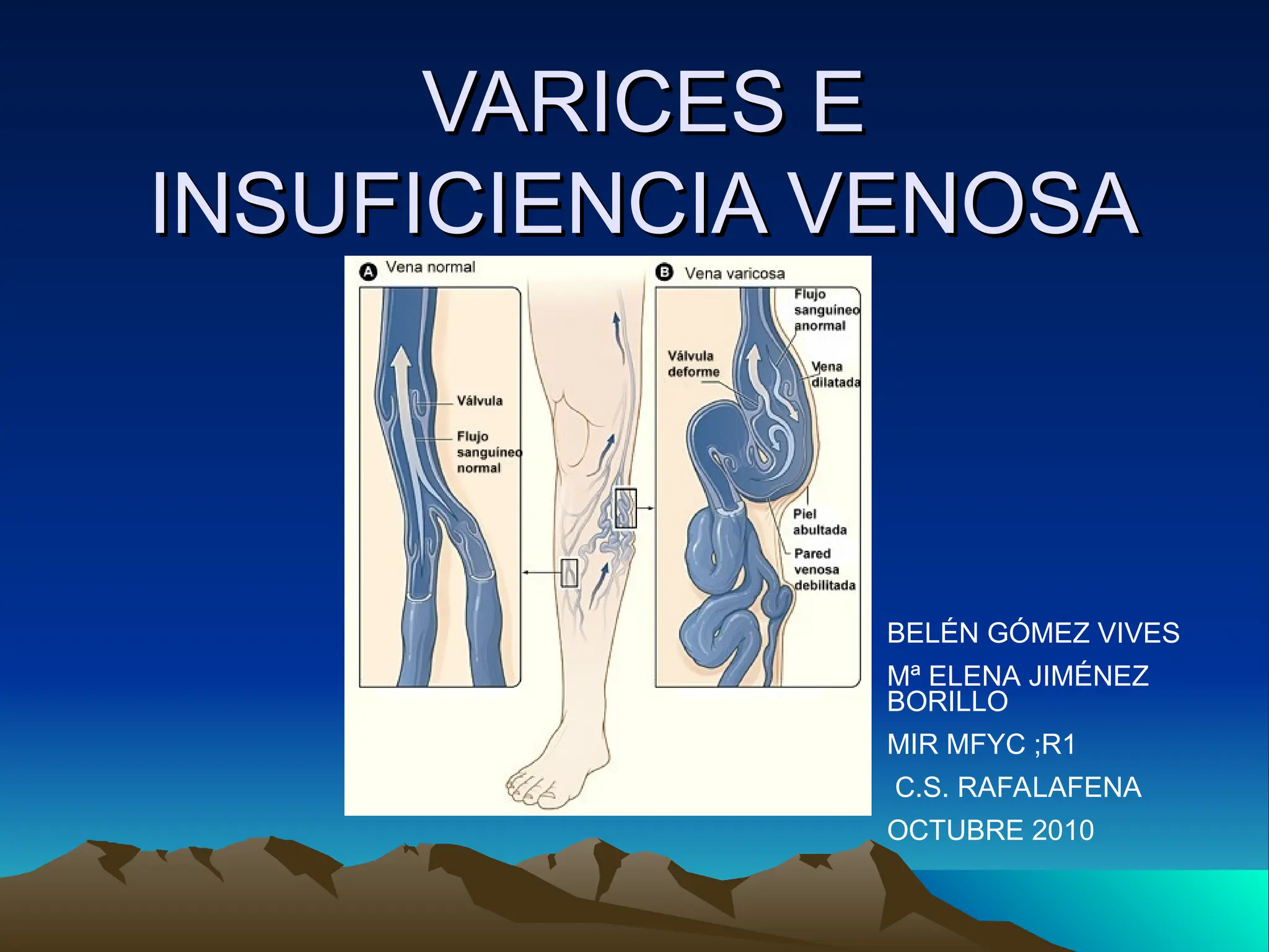 varices-e-insuficiencia-venosa________.ppt