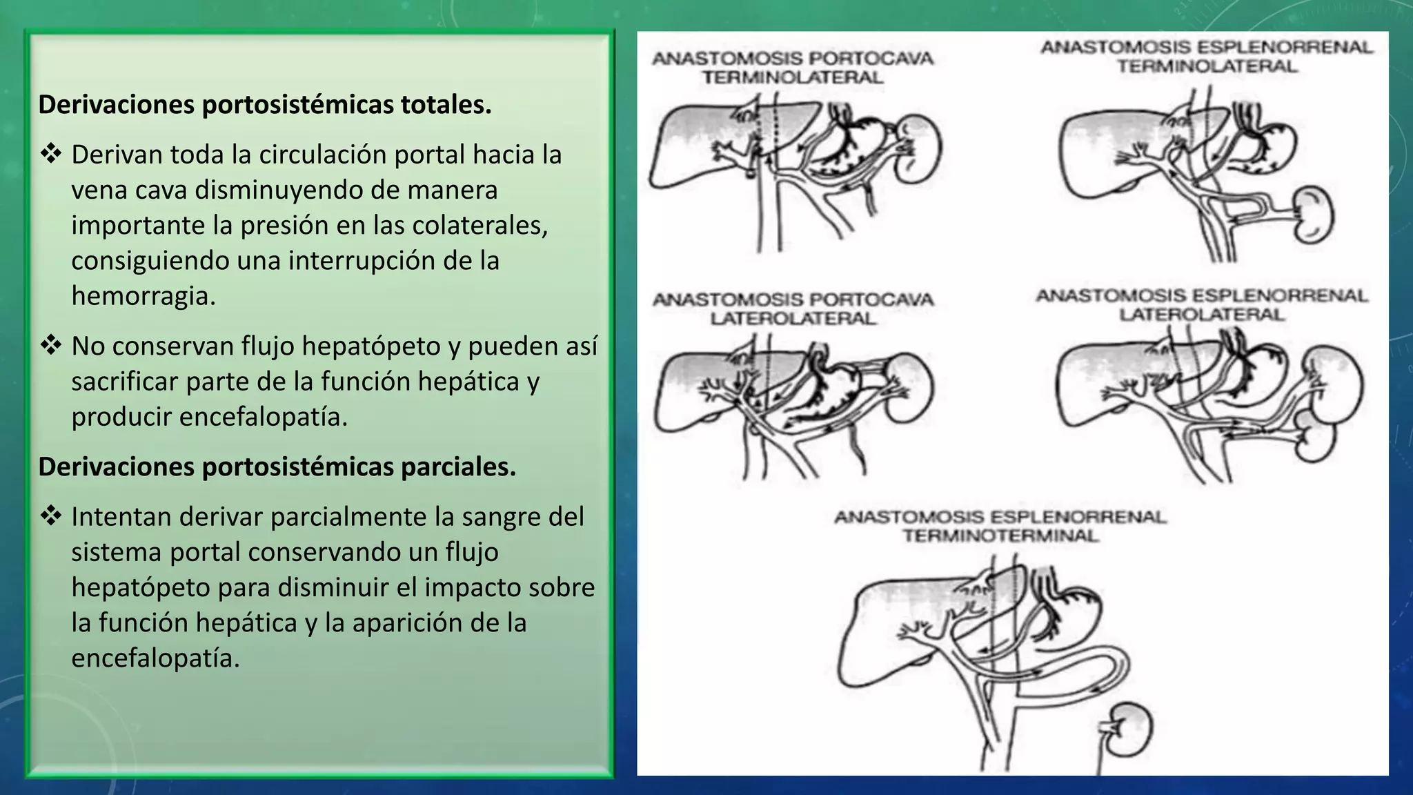 Varices esofagicas | PPTX