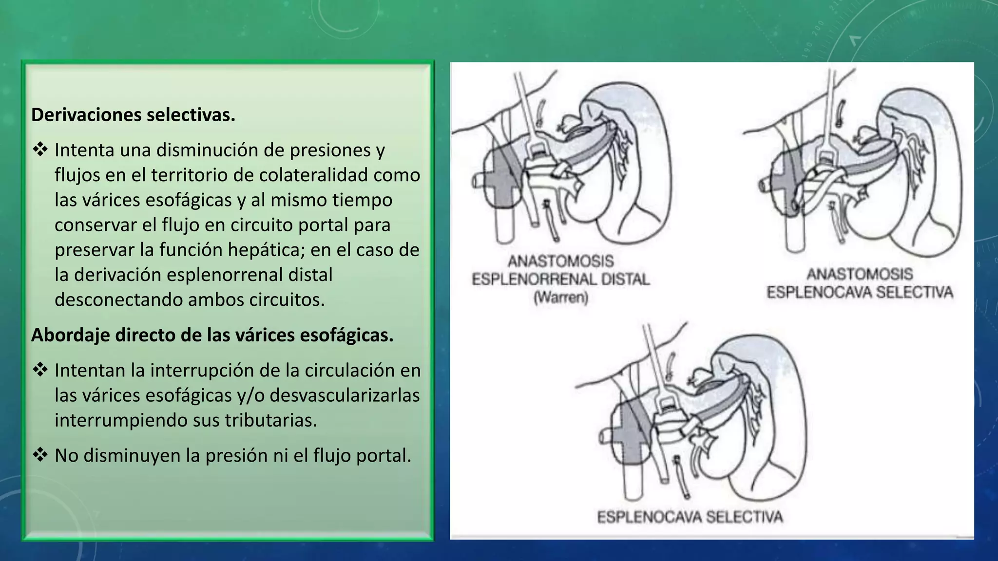 Varices esofagicas | PPTX