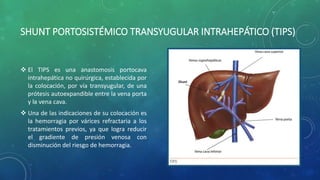 Varices esofagicas | PPT
