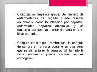 Varices esofágicas | PPTX