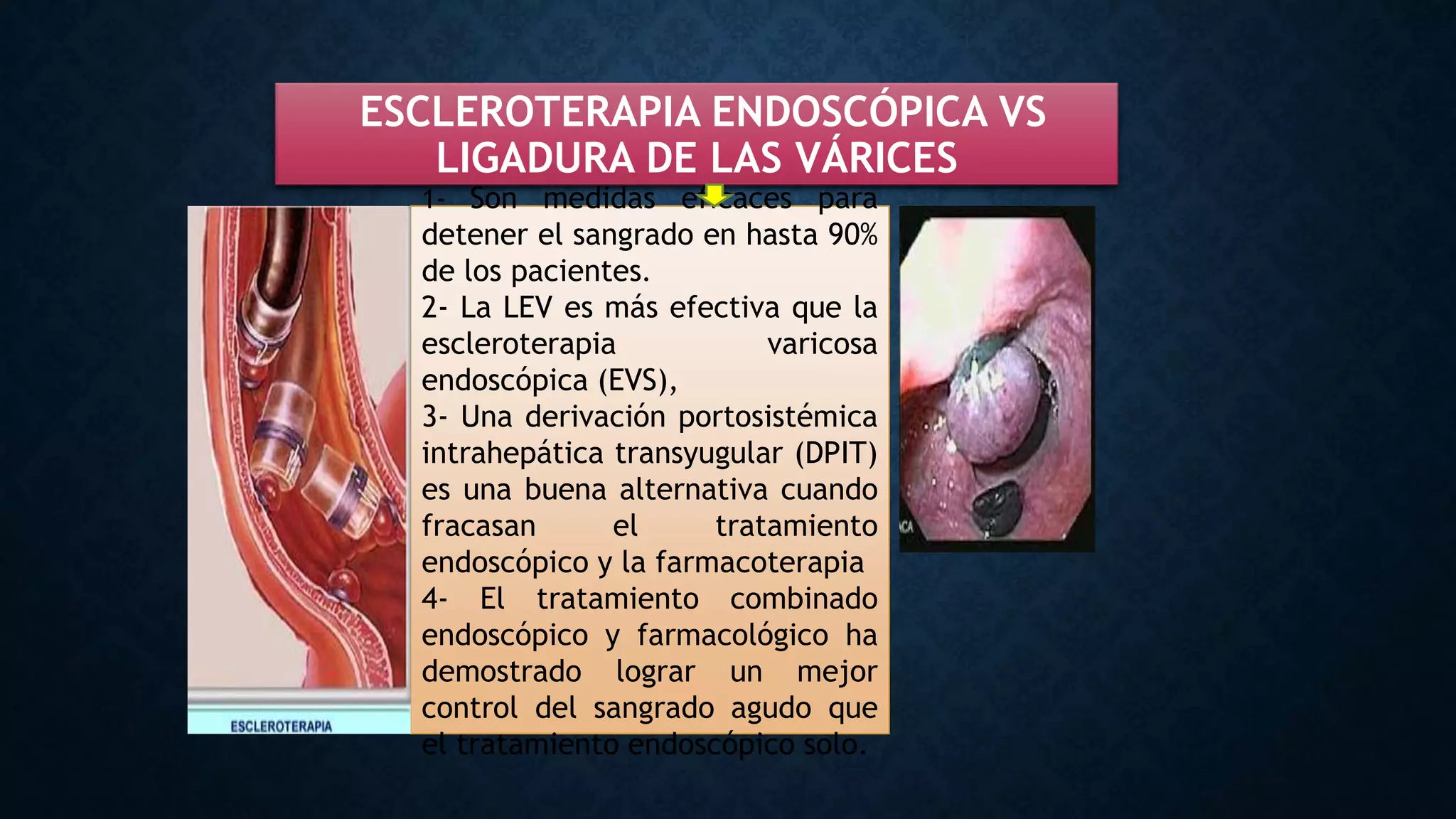 Varices esofágicas | PPTX