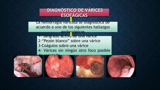 Varices esofágicas | PPTX