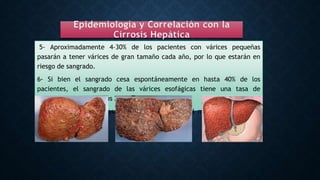 Varices esofágicas | PPTX