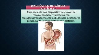 Varices esofágicas | PPTX